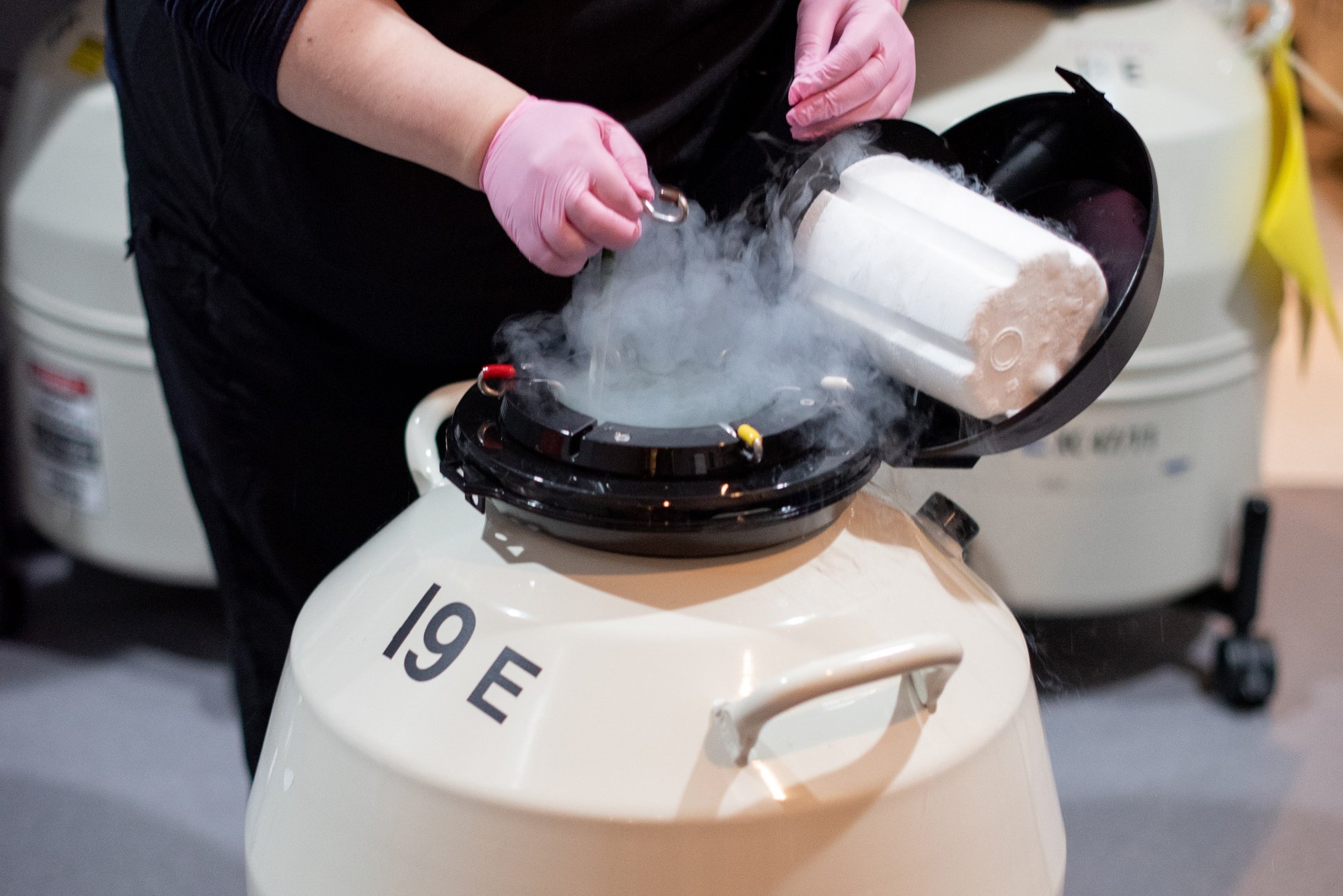 Egg freezing 101 [Oocyte Cryopreservation]