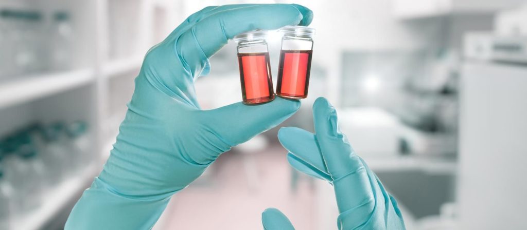 Hysterosalpingogram | Pacific Fertility Center Los Angeles