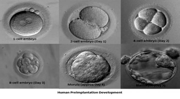 Day 3 vs. Day 5 Embryo Transfers